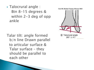 Ankle fractures management | PPTX