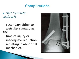 Ankle fractures management | PPTX