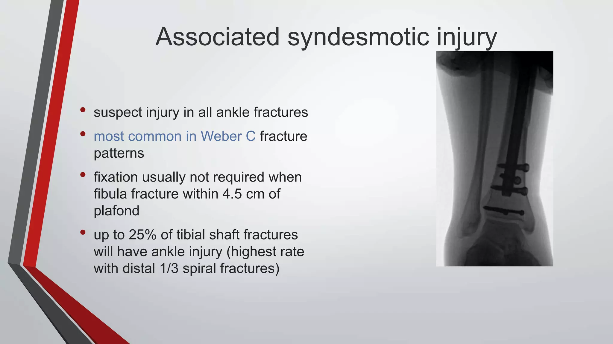 Ankle Fractures and Syndesmosis.pptx