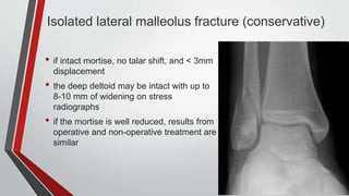 Ankle Fractures and Syndesmosis.pptx
