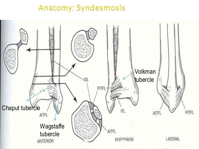 Anklefracturesfinal 120314092959-phpapp01