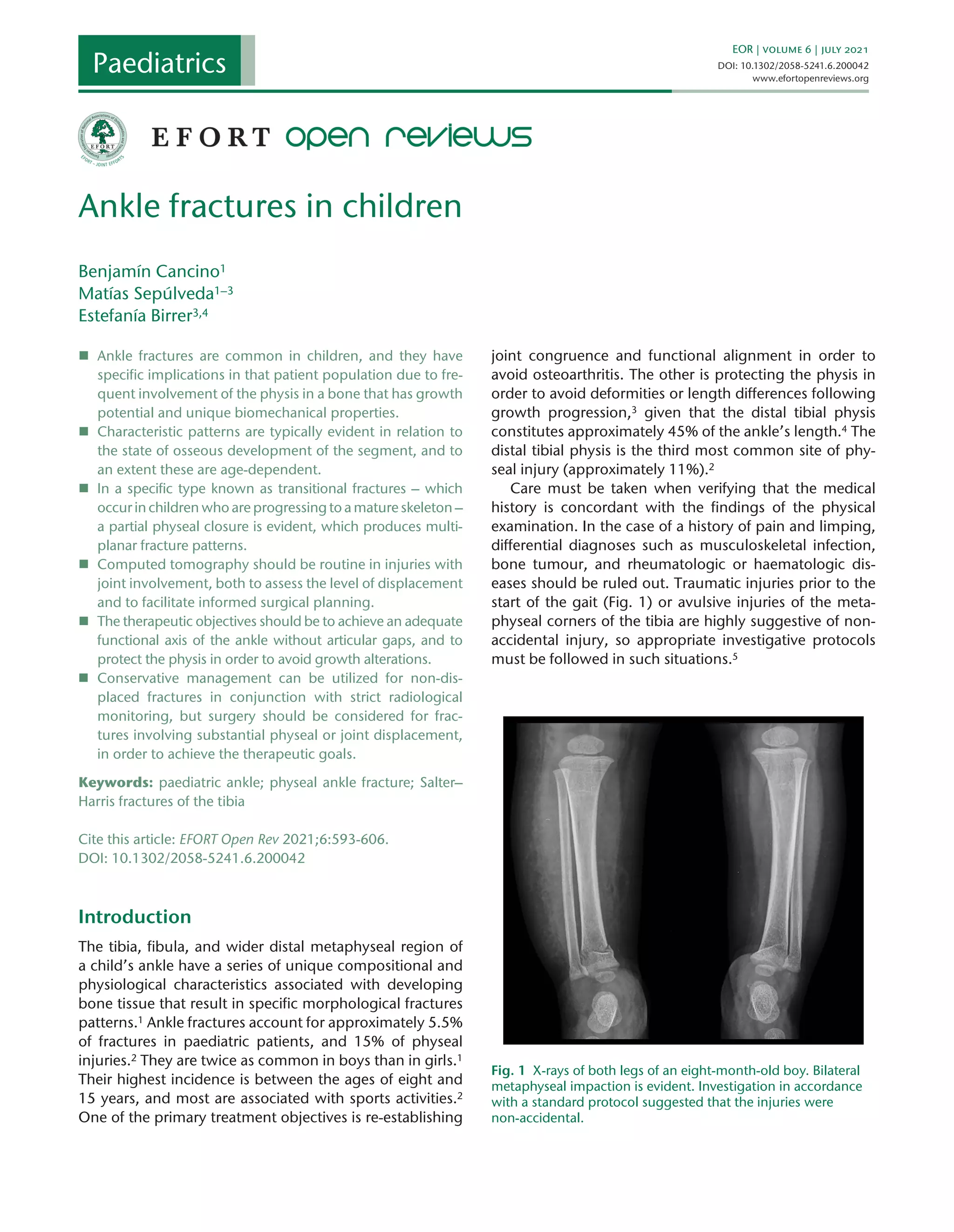 Ankle fractures in children 2021 | PDF