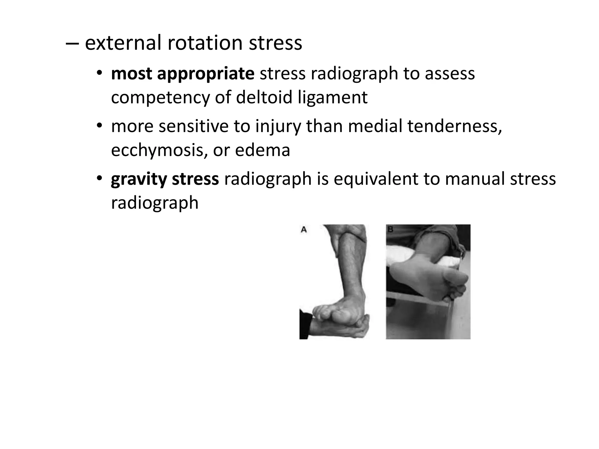 Ankle fractures | PPTX