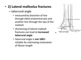 Ankle fractures | PPT