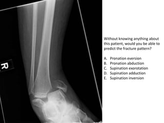 Ankle fractures question/image bank | PPTX