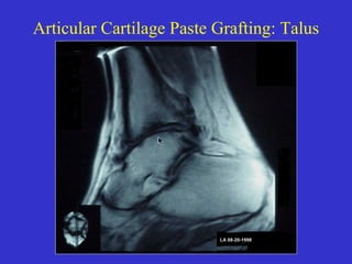 Ankle injuries | PPT