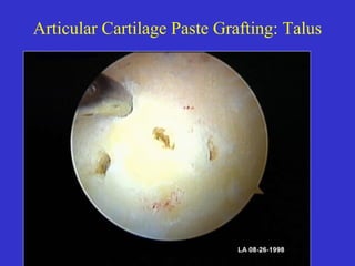Ankle injuries | PPT