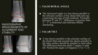 Ankle injuries | PPT
