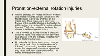ankle injuries.pptx