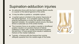 ankle injuries.pptx