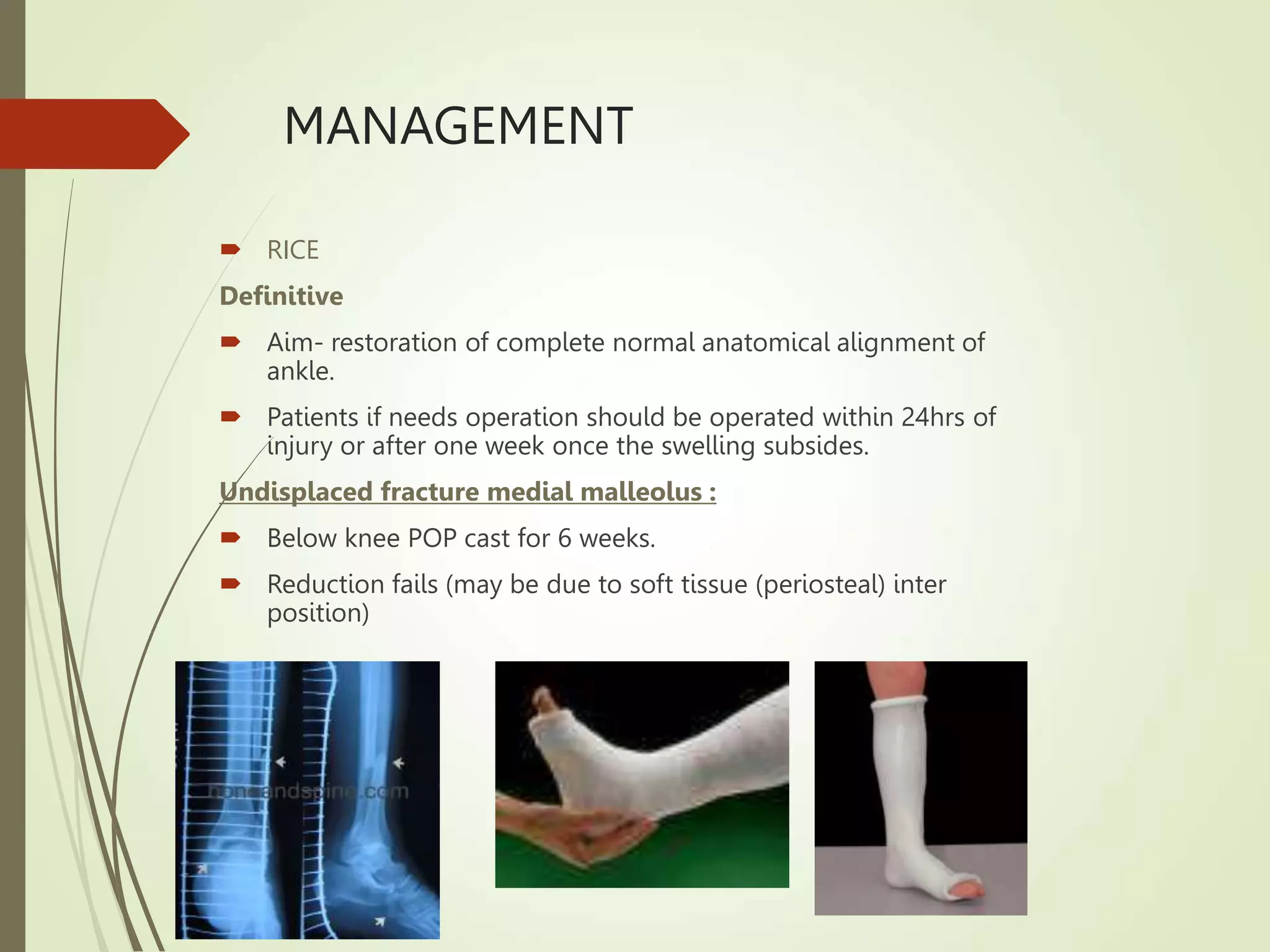 ANKLE_INJURIES.ppt