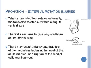 Ankle injuries - Copy.pptx