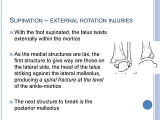 Ankle injuries - Copy.pptx