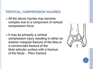 Ankle injuries - Copy.pptx