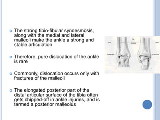 Ankle injuries - Copy.pptx