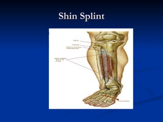 Ankle injuries in the realm of sports.ppt