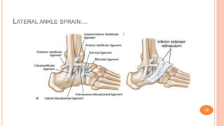 Ankle instability | PPTX