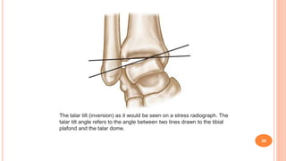 Ankle instability | PPTX