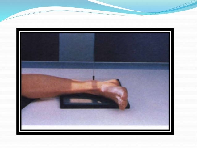 RADIOGRAPHIC VIEWS OF ANKLE JOINT