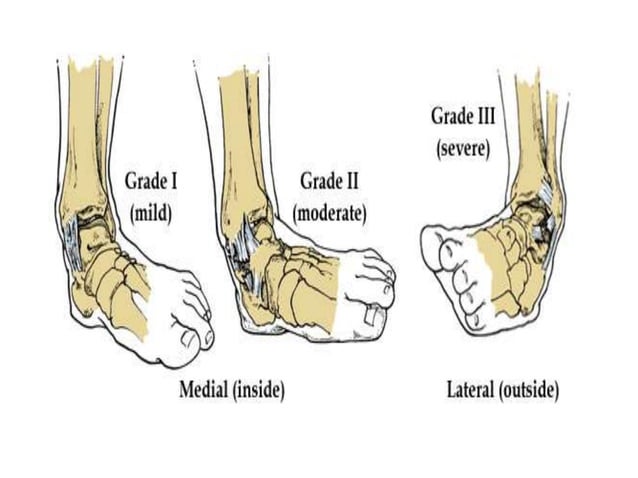Anatomy of Ankle joint | PPT