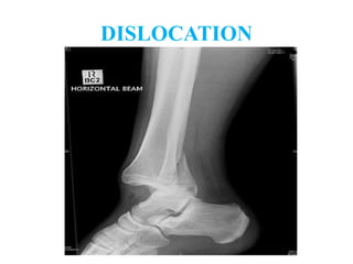 Anatomy of Ankle joint | PPT