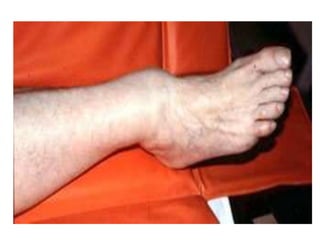 Anatomy of Ankle joint | PPT