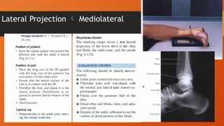 Ankle Joint teknik radiologi ankle joint | PPTX