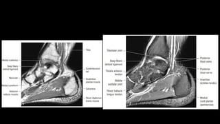 Introduction to ankle joint radiology- CT scan | PPTX