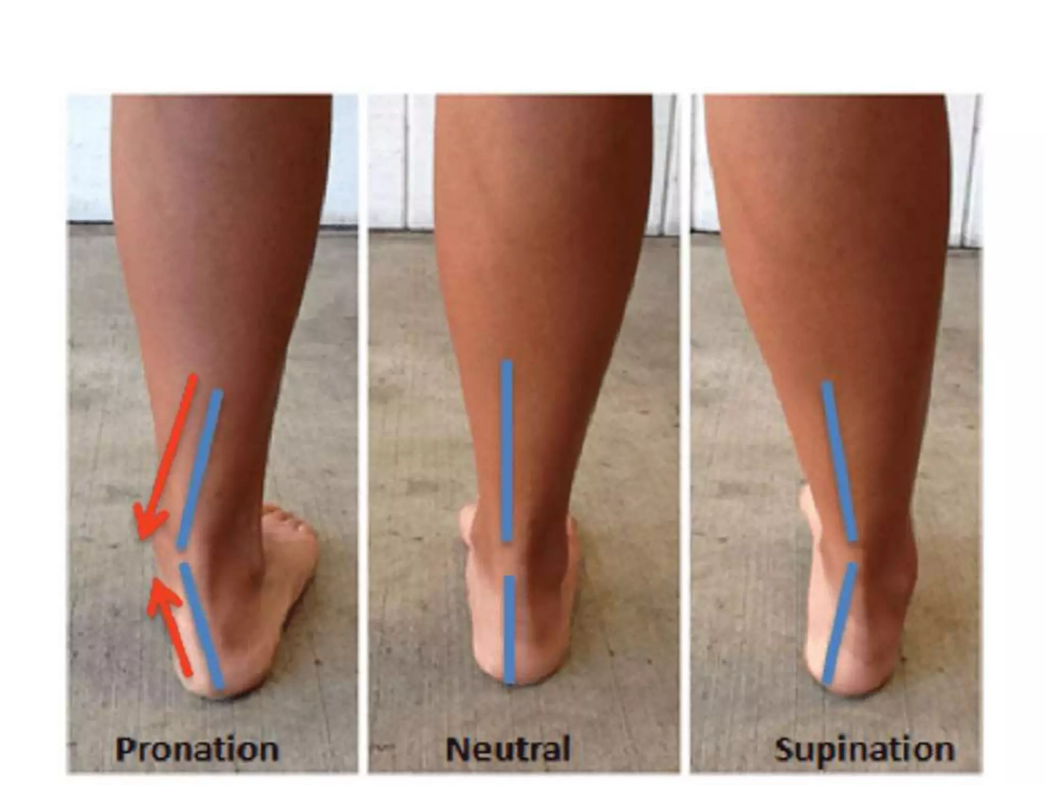 Ankle joint and joints of foot | PPT