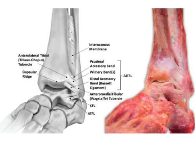 Ankle joint and joints of foot | PPT