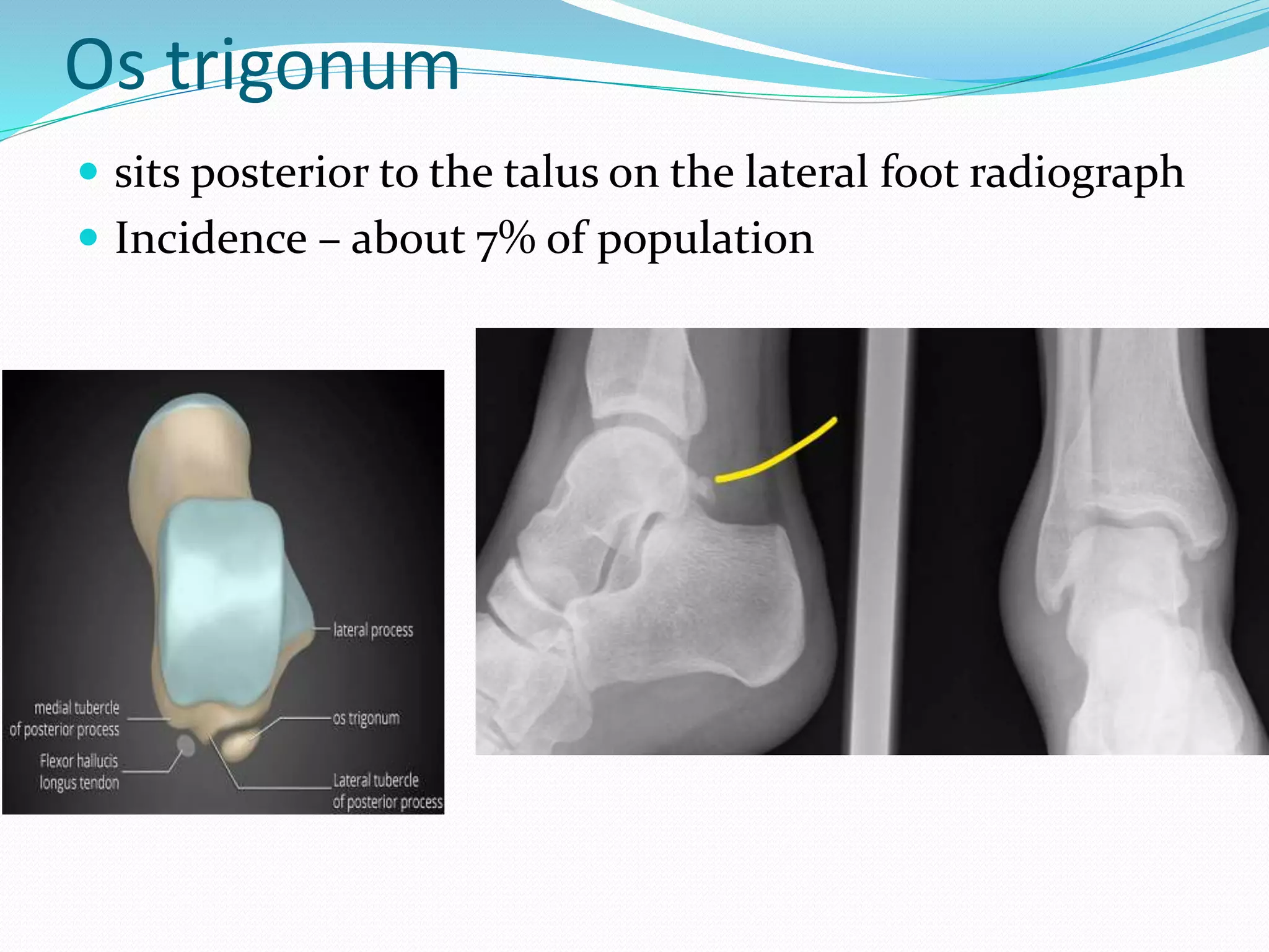 Ankle joint pathology imaging | PPTX
