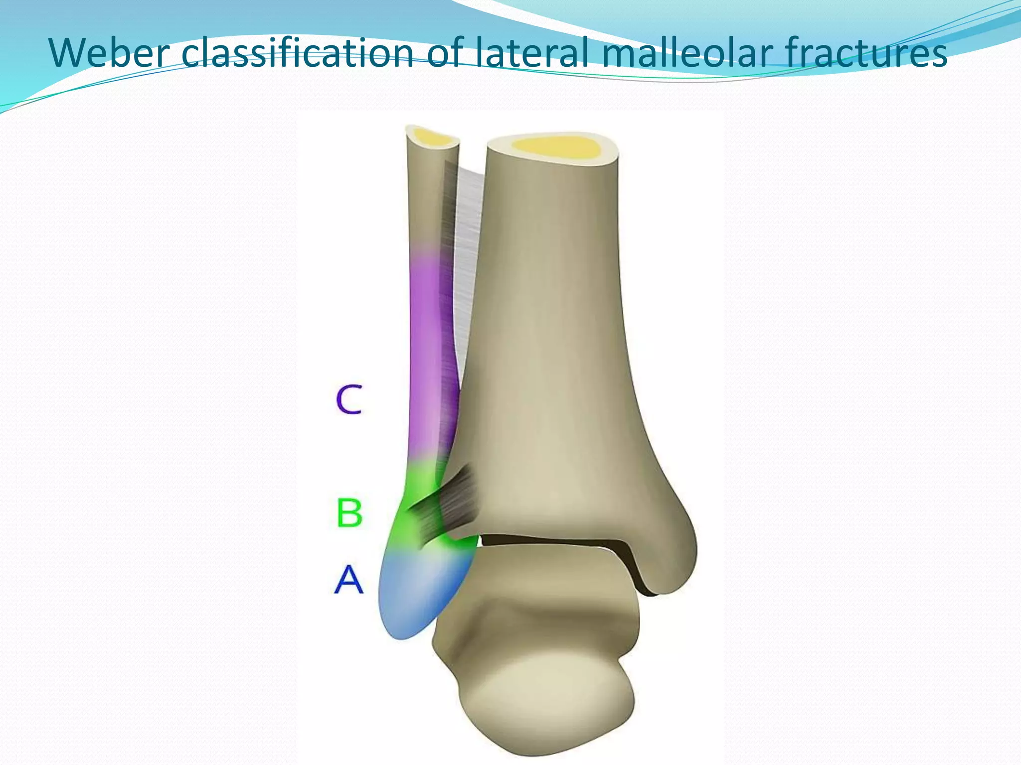 Ankle joint pathology imaging | PPTX