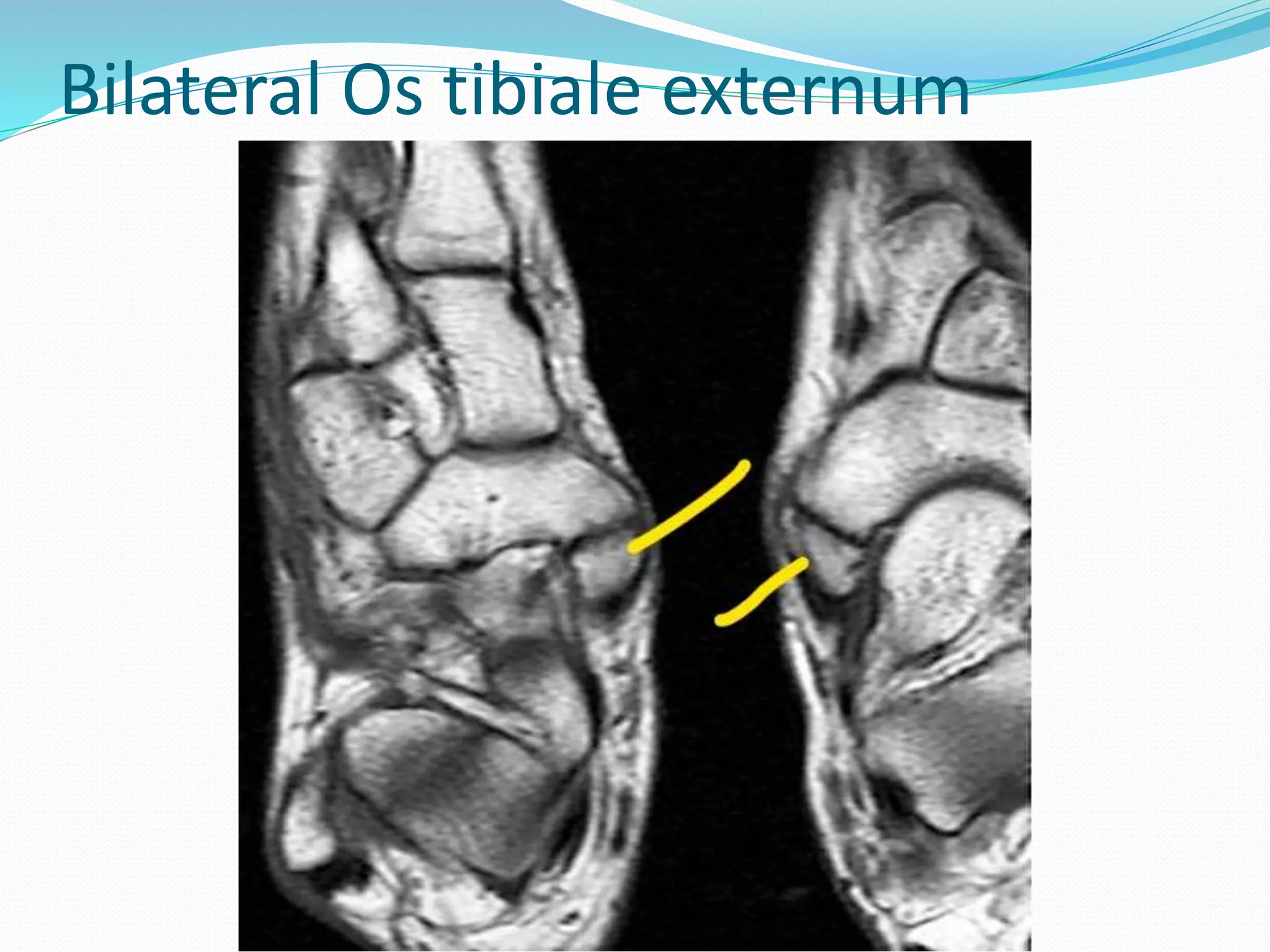 Ankle joint pathology imaging | PPTX