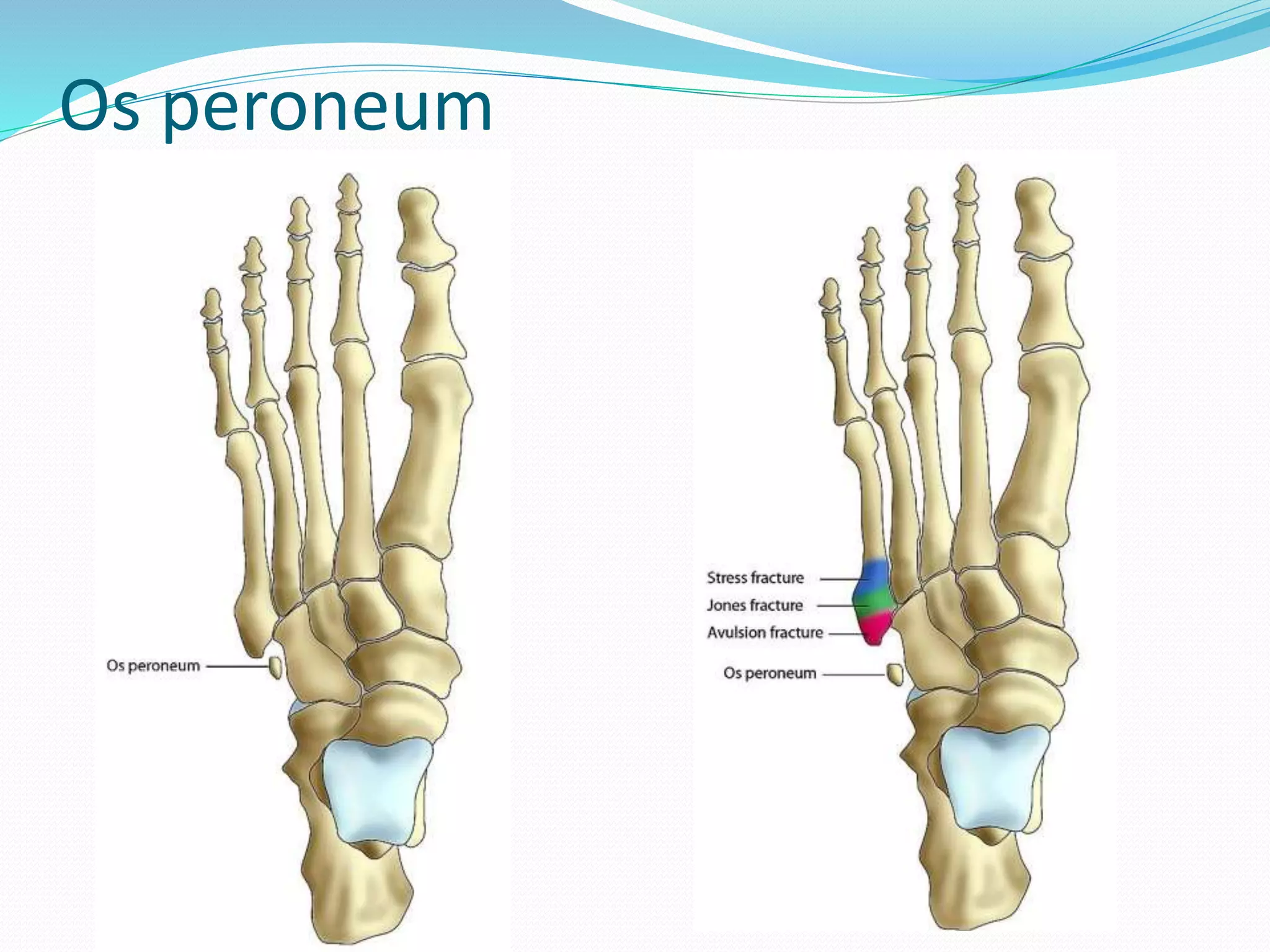 Ankle joint pathology imaging | PPTX
