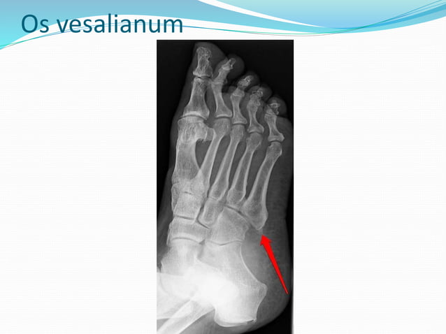 Ankle joint pathology imaging | PPTX