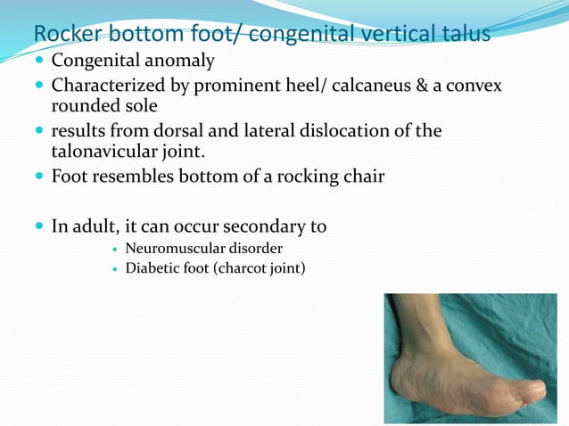 Ankle joint pathology imaging | PPTX