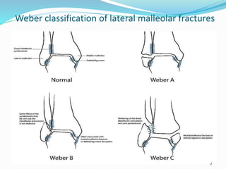 Ankle joint pathology imaging | PPTX