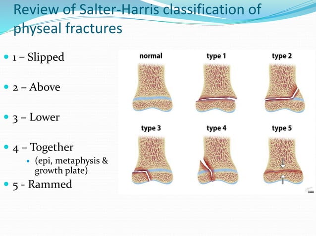 Ankle joint pathology imaging | PPTX