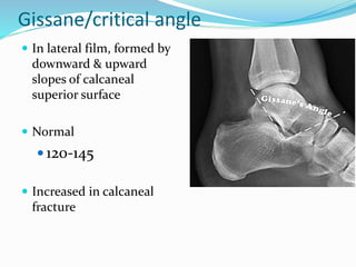 Ankle joint pathology imaging | PPTX