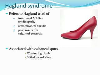 Ankle joint pathology imaging | PPTX