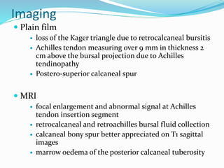 Ankle joint pathology imaging | PPTX