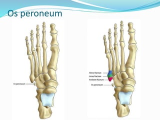 Ankle joint pathology imaging | PPTX