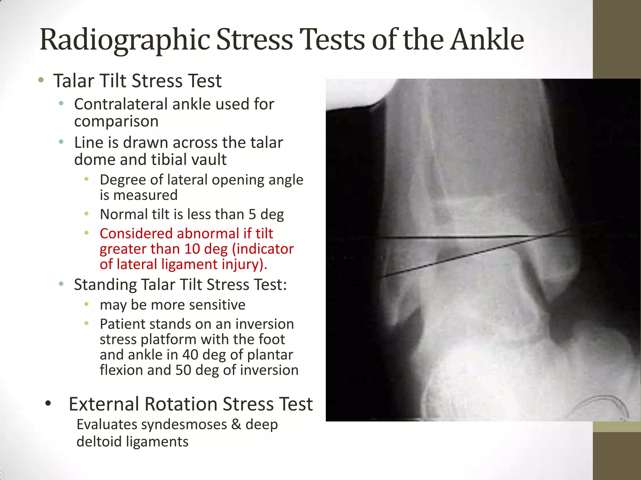 Ankle joint radiography | PPTX