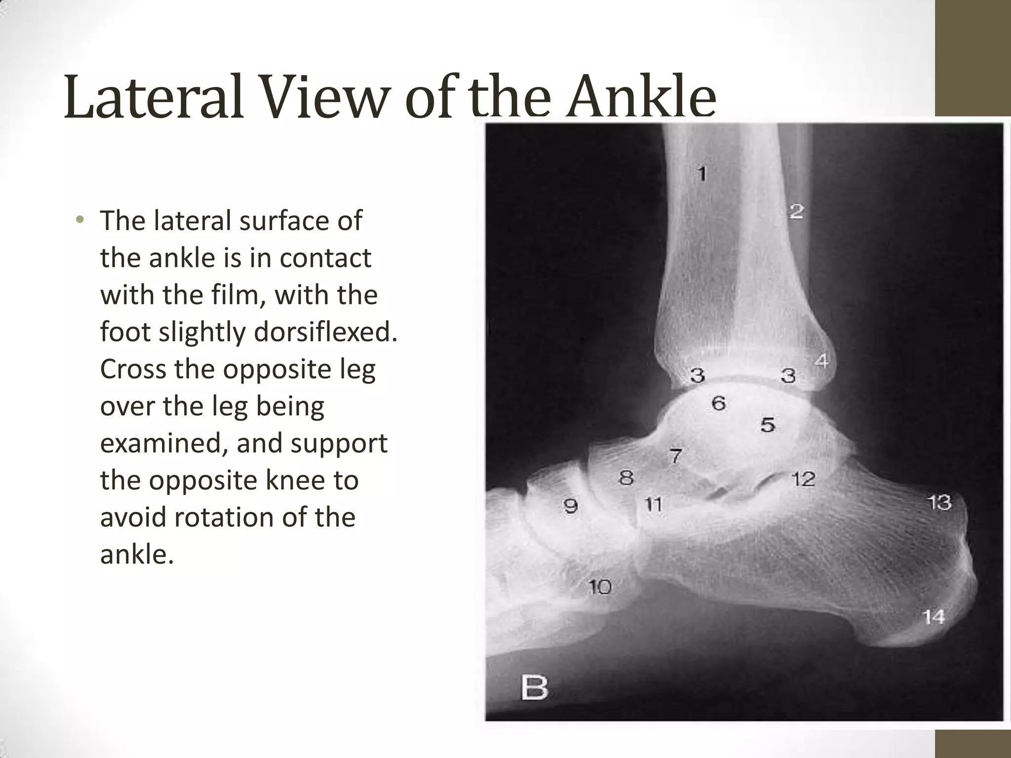 Ankle joint radiography | PPTX