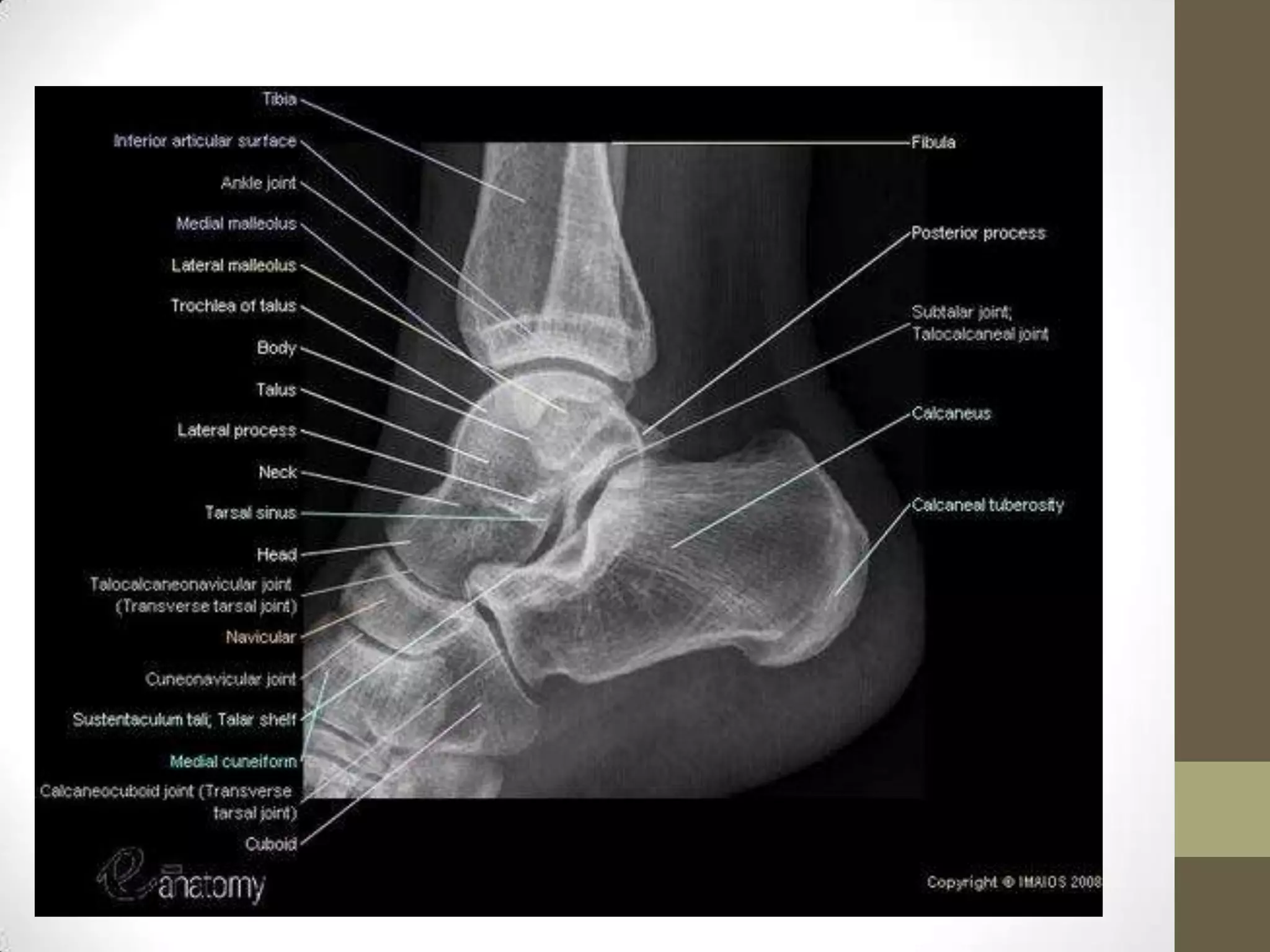 Ankle joint radiography | PPTX