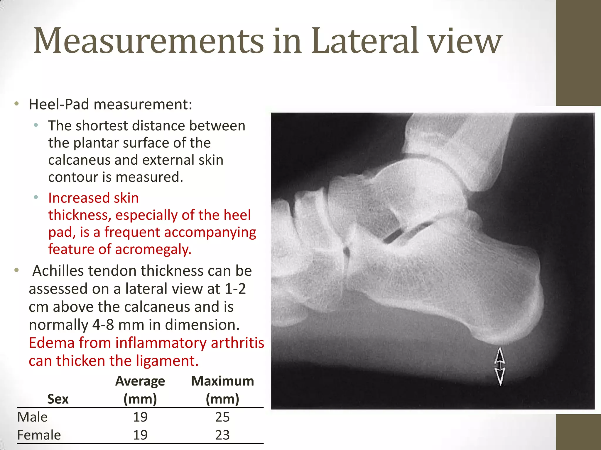 Ankle joint radiography | PPTX | Death, Injury, or Military Conflict ...