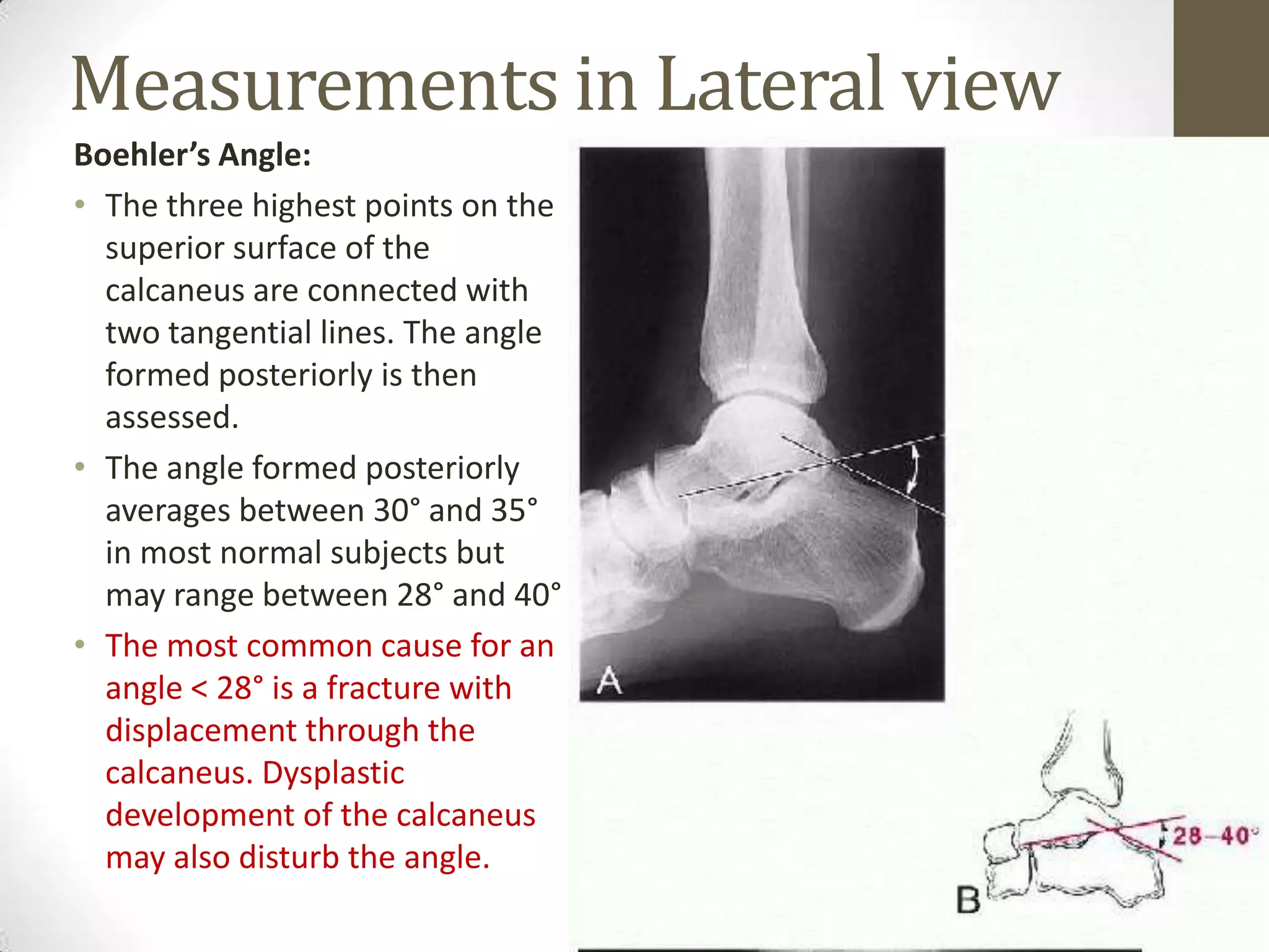 Ankle joint radiography | PPTX
