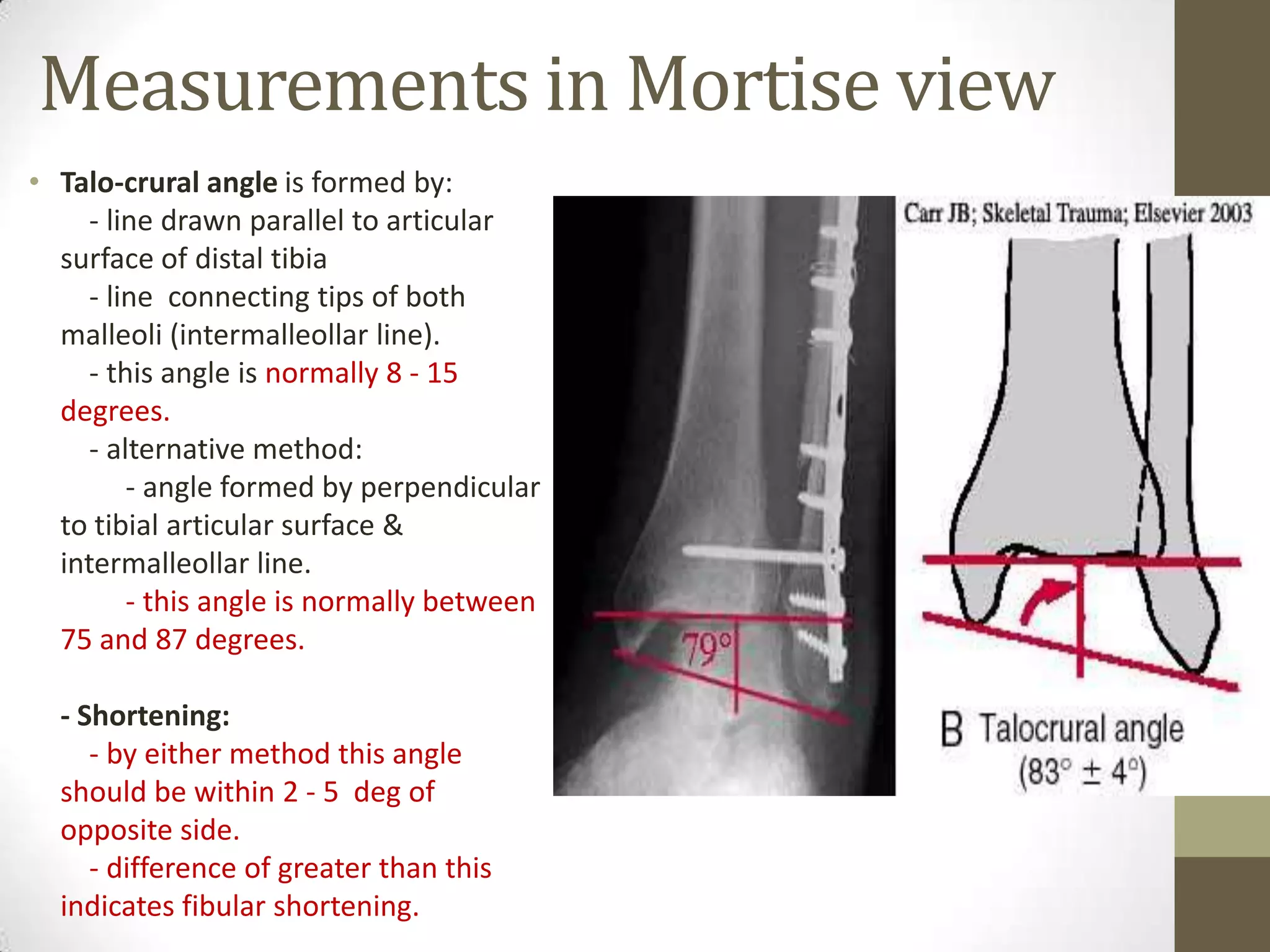 Ankle joint radiography | PPTX