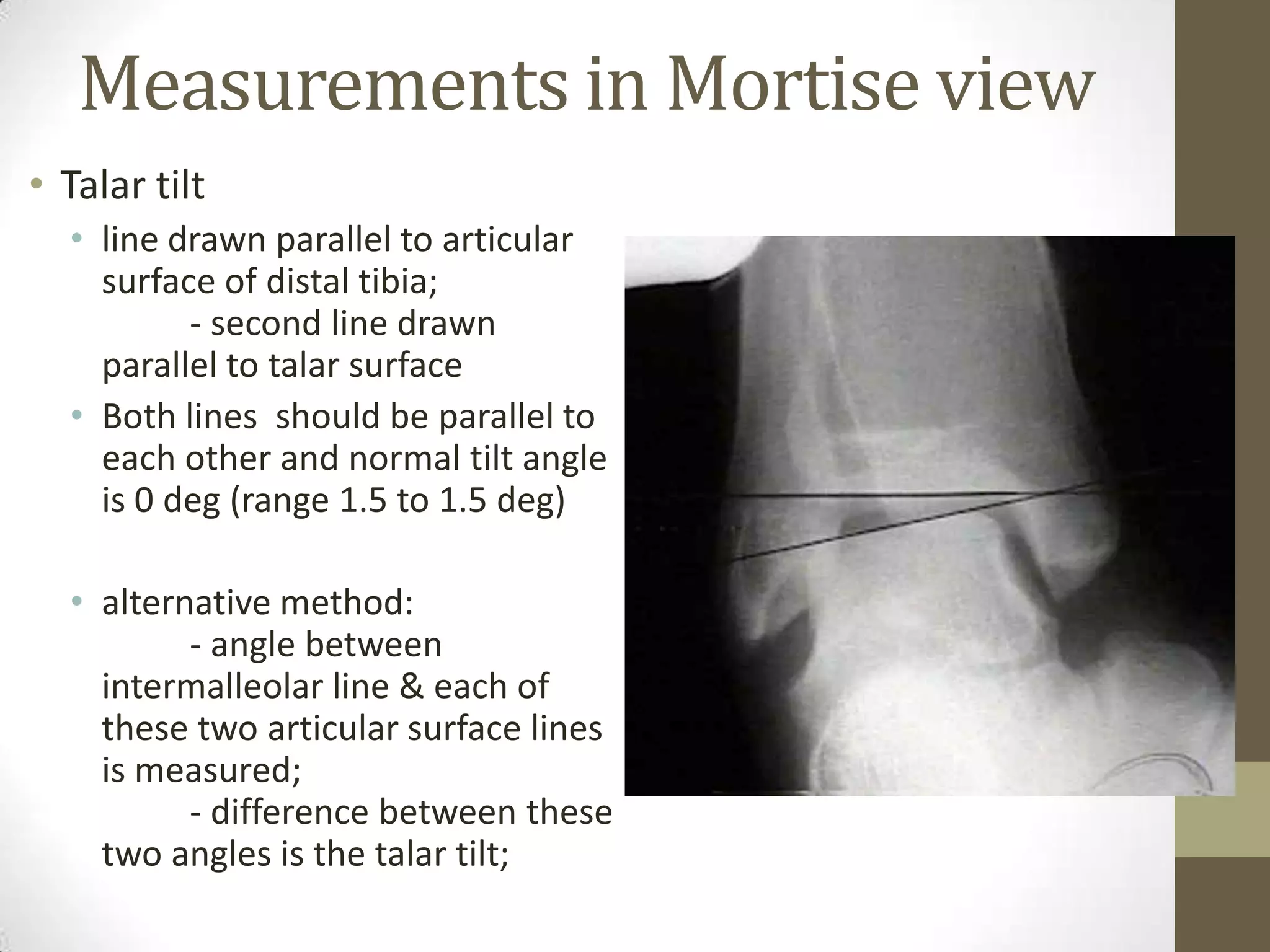 Ankle joint radiography | PPTX