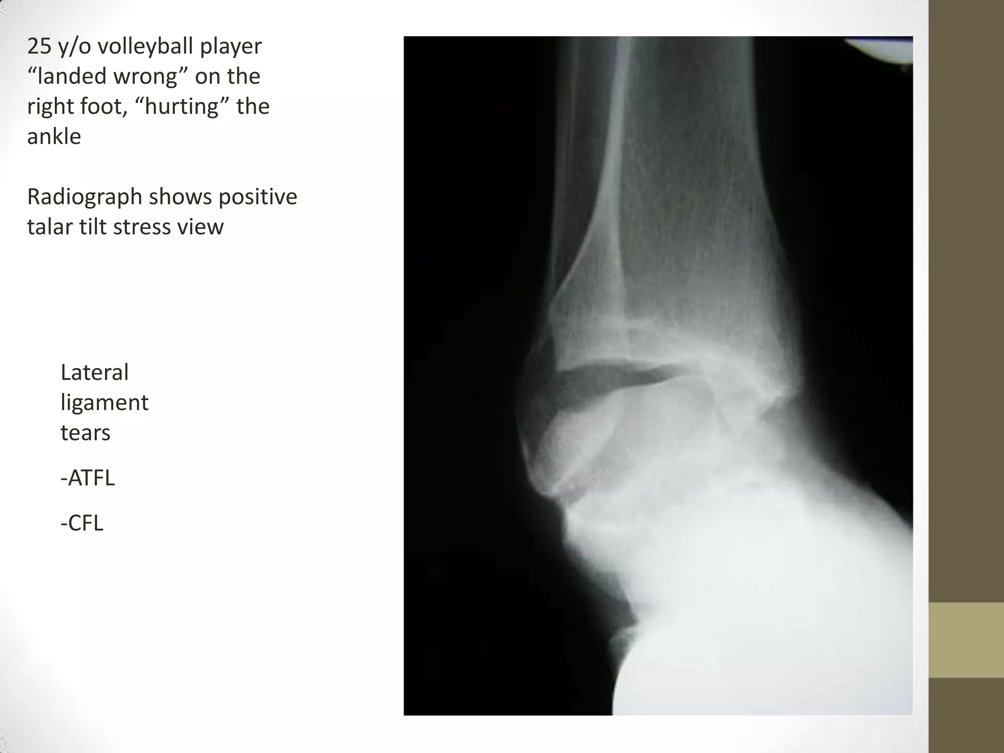 Ankle joint radiography | PPTX